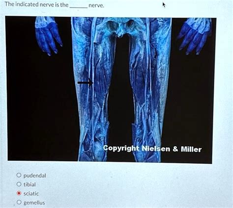 The Indicated Nerve Is The Nerve The Indicated Nerve Is The Nerve Copyright Nielsen Miller O