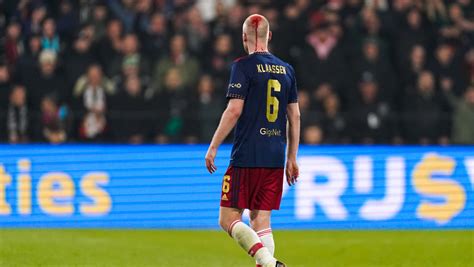 Un Futbolista Sufre Un Corte En La Cabeza Tras Ser Golpeado Por Un Objeto Lanzado Desde La