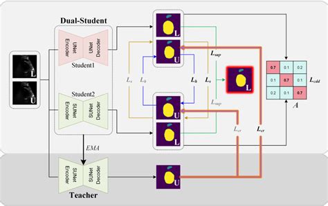 [논문 리뷰] Intrapartum Ultrasound Image Segmentation Of Pubic Symphysis And Fetal Head Using Dual