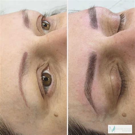 Eyebrow Tattoo Vs Microblading Key Differences