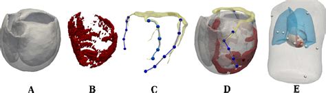 Figure 1 From Personalized Cardiac Computer Models And Machine Learning For Target Vein