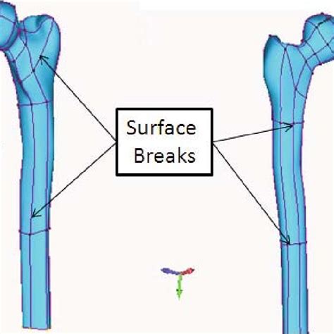 Cad Model Of Proximal Femur Courtesy Of Saec Kinetic Vision
