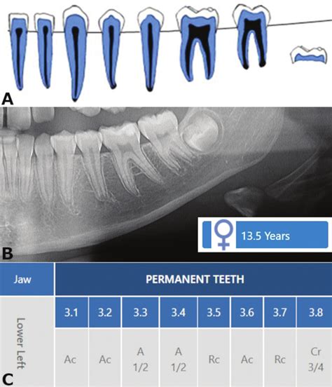 Illustration Of The Radiographic Analysis Performed For Dental Age Download Scientific Diagram