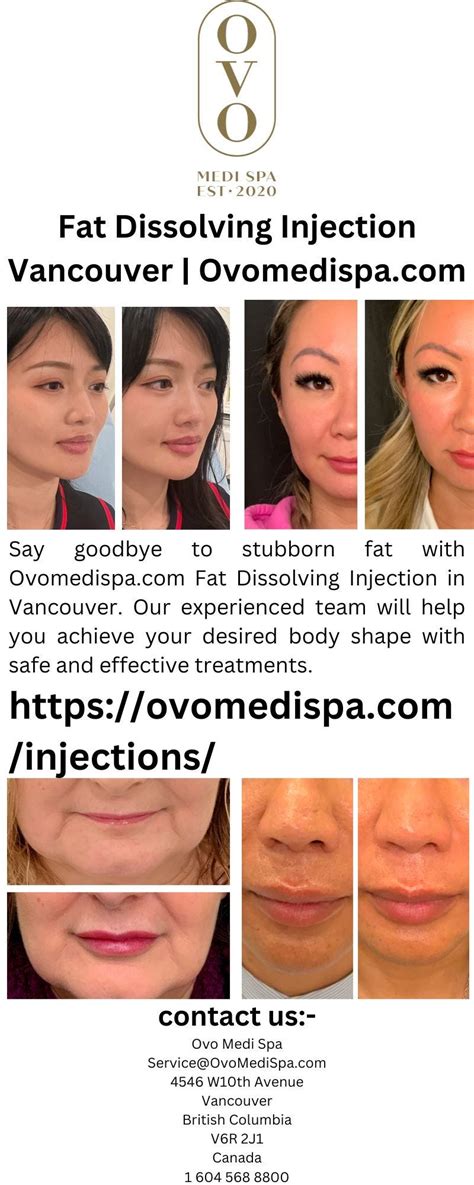 Fat Dissolving Injection Vancouver Ovomedispa Medium