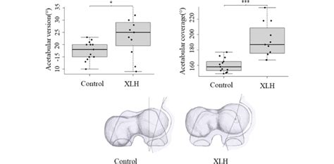 Acetabular Version And Acetabular Coverage For The Two Groups For The Download Scientific