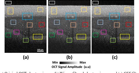 An Adaptive Cluster Based Filtering Framework For Speckle Reduction Of Oct Skin Images