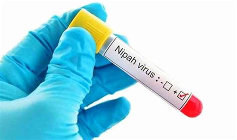Nipah Virus In Kerala State Govt To Increase Testing