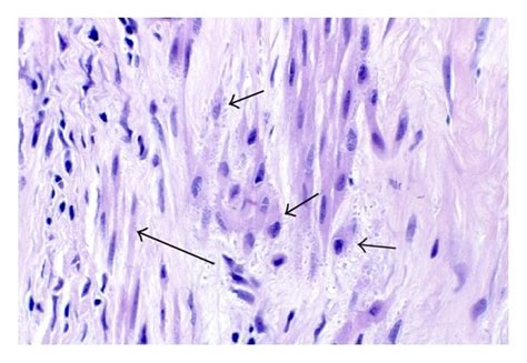 Phenotypic Transformation Loss Of Lateral Bars Lateral Bars Arrows Download Scientific