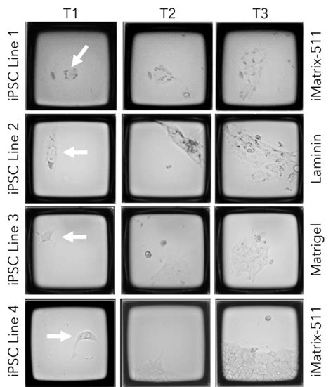 Overcoming Bottlenecks For Ipsc Workflows Cell Microsystems