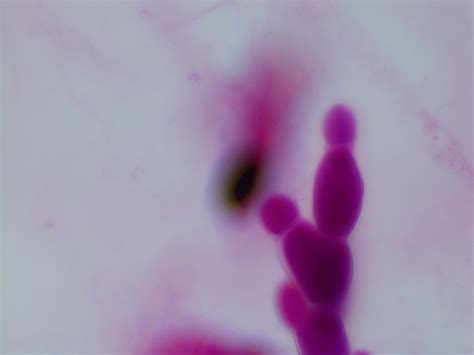 Allomyces Gametophyte 2 M K Flickr