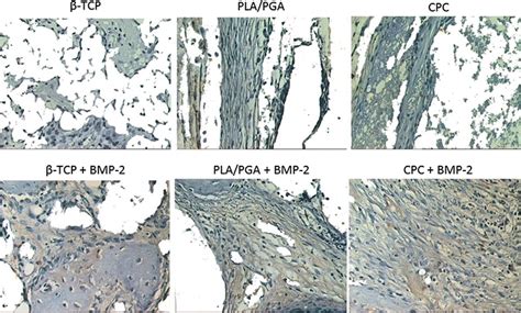 Immunohistochemical Analysis Of Runt Related Transcription Factor 2 Of
