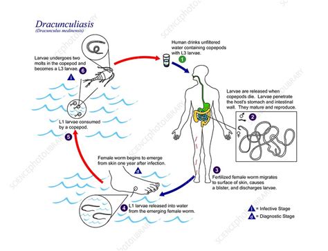 Guinea Worm Parasite Life Cycle Stock Image C0096231 Science Photo