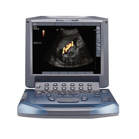Ecógrafo Sonosite Micromaxx Global Ultrasonido