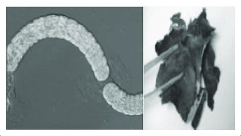 Confocal Microscopy Of I Arthrospira Platensis Ii Arthrospira