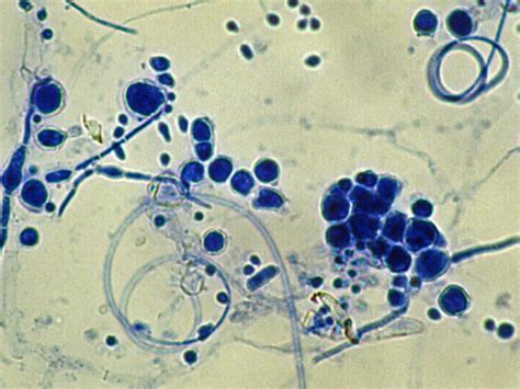 Trichophyton Mycology University Of Adelaide
