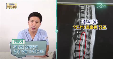 허리디스크 환자에게 코어운동이 중요한 이유안보면 후회 보장 인스티즈instiz 이슈 카테고리