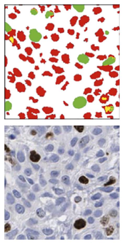 Example Applications Using Gans A Organ Lung And Heart