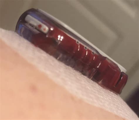 Had To Take This Off Not Even 10 Minutes After I Put It On R Dexcom