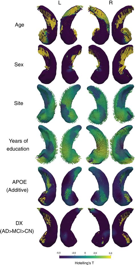 Directional Effect On The Surface Of The Hippocampus For From Top To