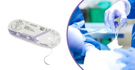 Scalp Vein Set Different Types Sizes And The Medical Uses