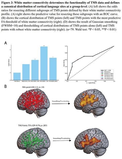 Nexstim On Linkedin Preoperative Brain Mapping Predicts Language Outcomes After Eloquent Tumor