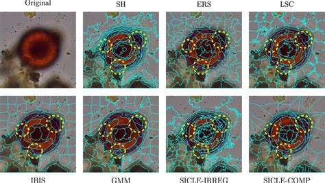Qualitative Results With An Image From Parasites Requiring 100 Download Scientific Diagram