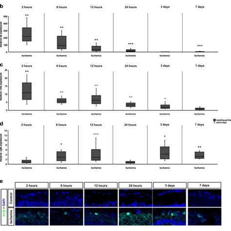 Schematic Overview Of Study Results Retinal Ischemiareperfusion Led Schematic Overview Of Study Results Retinal Ischemiareperfusion Led