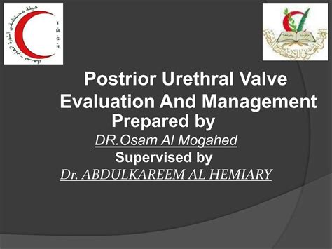 Posterior Urethral Valve Pptx Posterior Urethral Valve Pptx