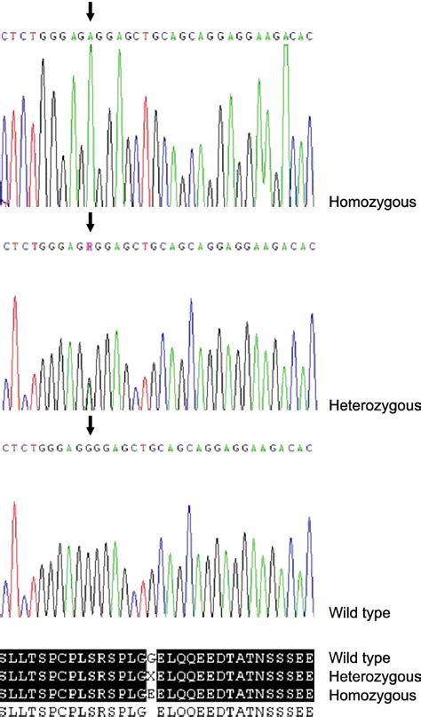 The DNA Sequence Of Exon Of The HR Gene The Arrow Indicates The Download Scientific Diagram