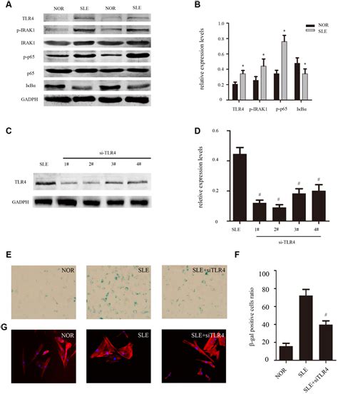 Targeting Hmgb1 By Ethyl Pyruvate Ameliorates Systemic Lupus Erythematosus And Reverses The