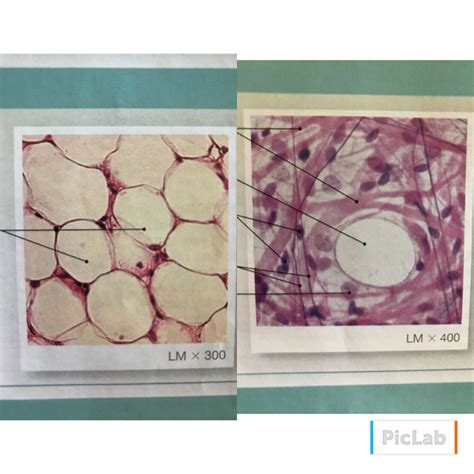 Gap Lab Practical Part 7 Diagram Quizlet