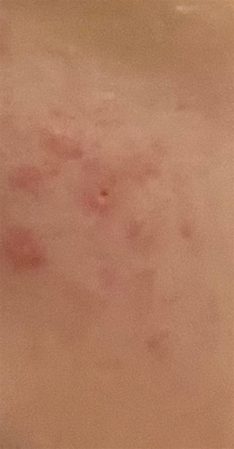 얼굴에 구멍 지식in