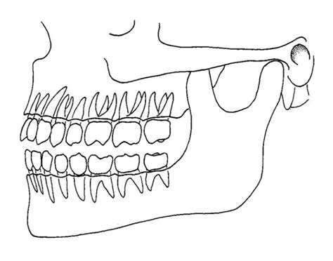 Permanent Dentition Eruption Pattern Quiz