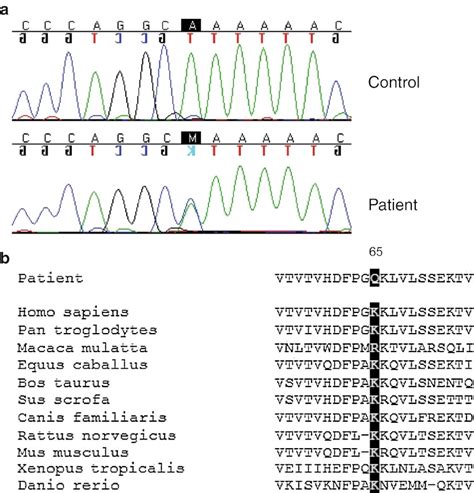 Novel Sequence Variation Found In 3 Atypical Hemolytic Uremic Syndrome