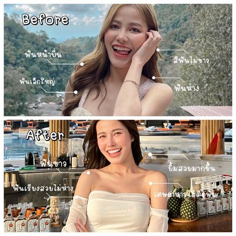 เคล็บไม่ลับดูแลสุขภาพฟันให้ตัวเองยิ้มสวยย 📸 แกลเลอรีที่โพสต์โดย