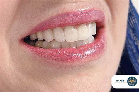 گالری دندانپزشکی دکتر ادیب