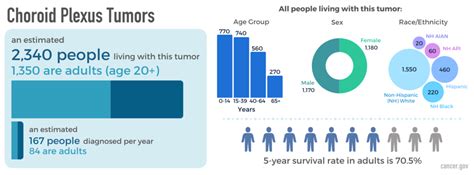 Choroid Plexus Tumor Diagnosis And Treatment Nci
