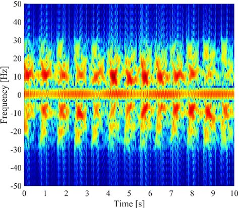 Figure 1 From Ecg Signal Reconstruction Via Doppler Sensor By Hybrid Deep Learning Model With