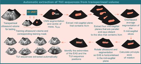 Proposed Pipeline Of The Automatic Tui Extraction Algorithm Download