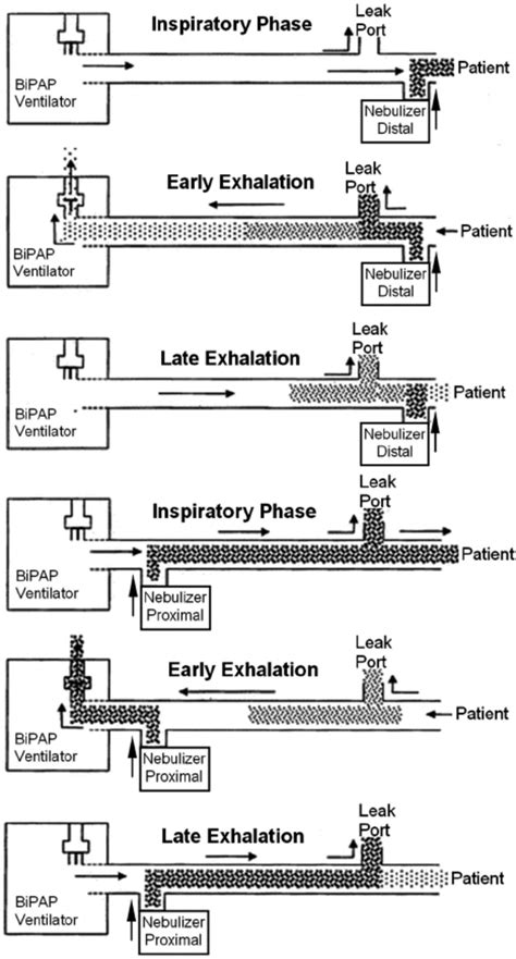 Albuterol Delivered Via Nebulizer Versus Metered Dose Inhaler Via The Download Scientific