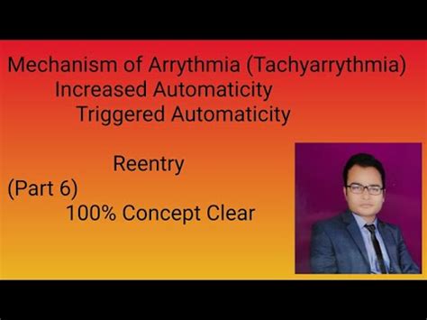 Mechanism Of Arrhythmia Tachyarrythmia Increased Automaticity Triggered Automaticity Reentry