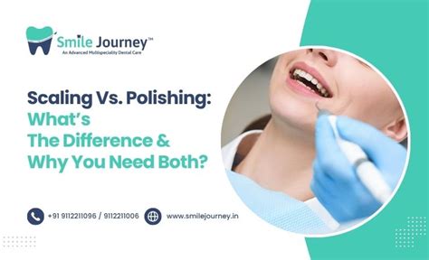 Scaling Vs Polishing Whats The Difference And Why You Need Both