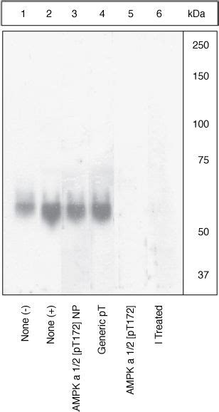 Anti Ampk Alpha 1 Phospho T183 Ampk Alpha 2 Phospho T172 Antibody