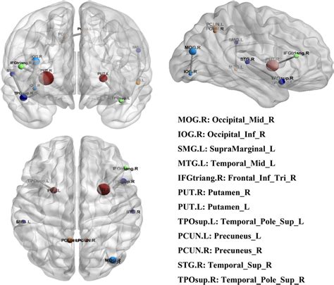 The Selected Relevant Connections And The Corresponding Brain Regions Download Scientific