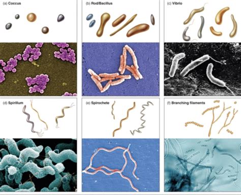 Microbiology Final Flashcards Quizlet