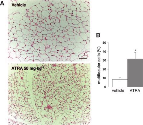 Atra Treatment Increases The Appearance Of Multilocular Adipocytes In