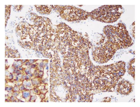 Autopsy Findings A B Choroid Plexus A Hematoxylin And Eosin Download Scientific Diagram