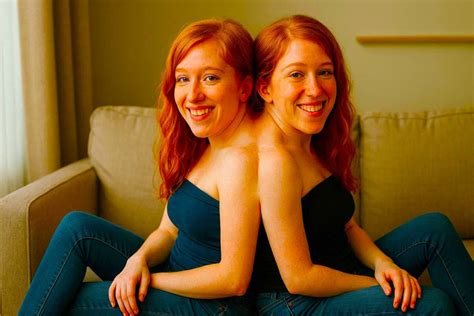 Tiffani And Samantha Larson By Joinedsiamesetwins On Deviantart