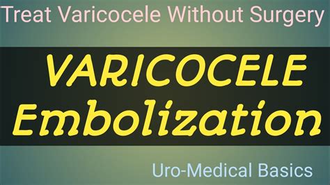 Varicocele Embolization Interventional Radiology Procedures Youtube