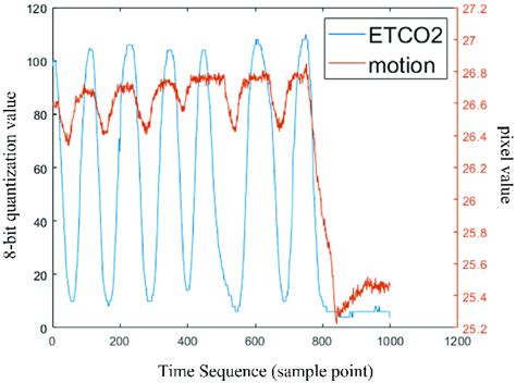 The Waveform Of Etco2 Ground Truth And Motion Signal Extracted From Download Scientific